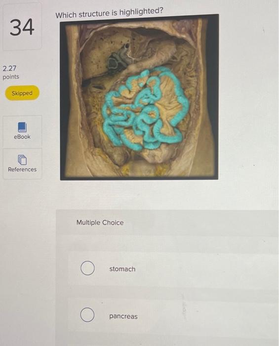 Solved Which structure is highlighted? 35 2.27 points | Chegg.com
