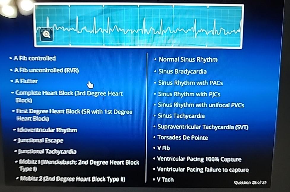Afib controlledA Fib uncontrolled | Chegg.com