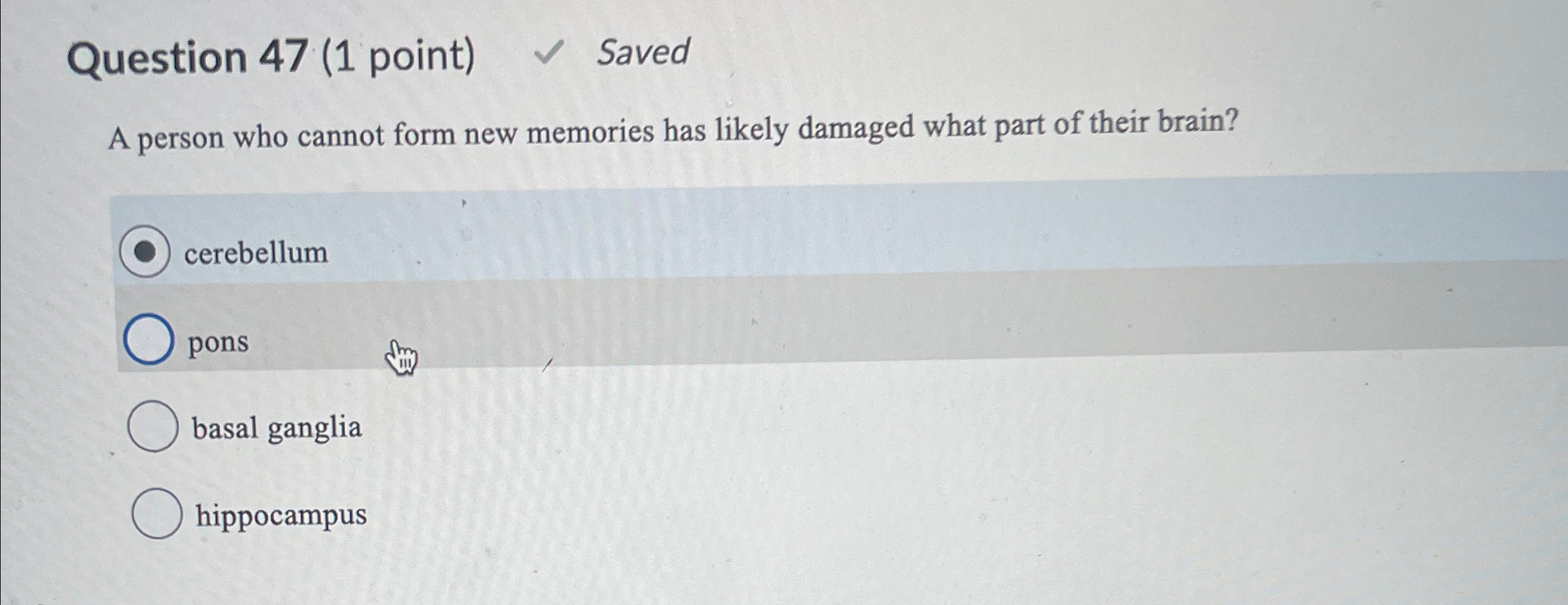 Solved Question 47 (1 ﻿point) ﻿SavedA person who cannot | Chegg.com