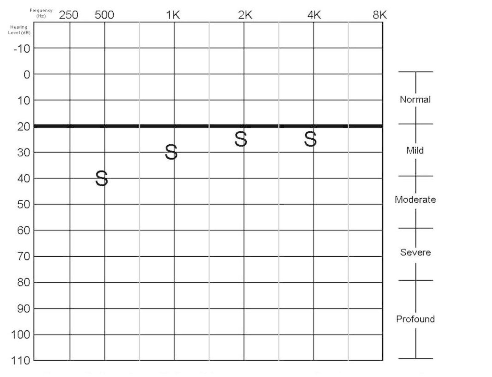 Solved How was this audiogram elicited? Be specific in what | Chegg.com
