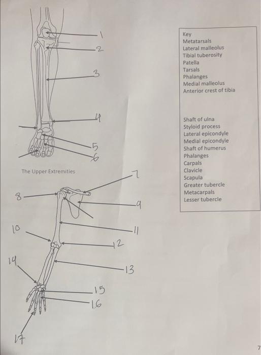 Solved Label the bones and key landmarks. Key | Chegg.com