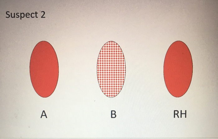 Solved Blood Typing: how to read Blood Type Reactions w/ | Chegg.com