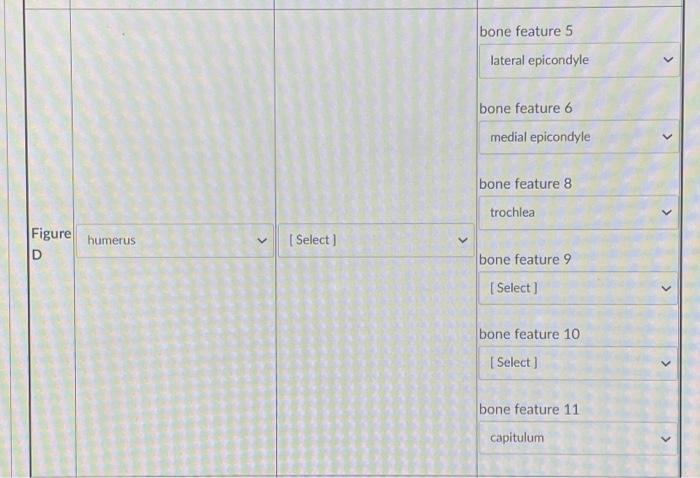 Label the upper limb bone \& portion | Chegg.com