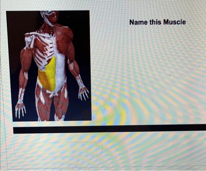 Solved Name this Muscle | Chegg.com
