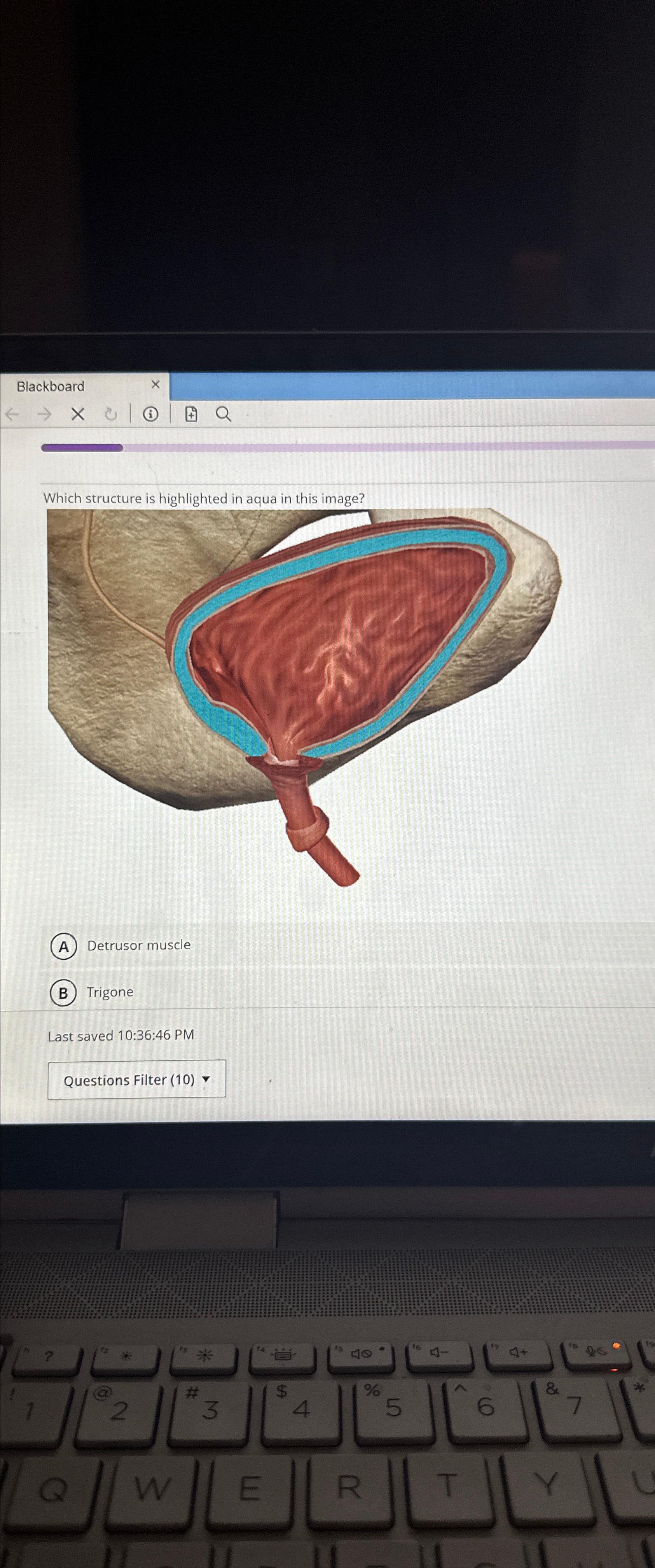 Solved Which structure is highlighted in aqua in this | Chegg.com