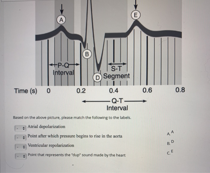 Solved E A B +P-Q. Interval S-T D Segment Time (s) 0 0.2 0.6 | Chegg.com