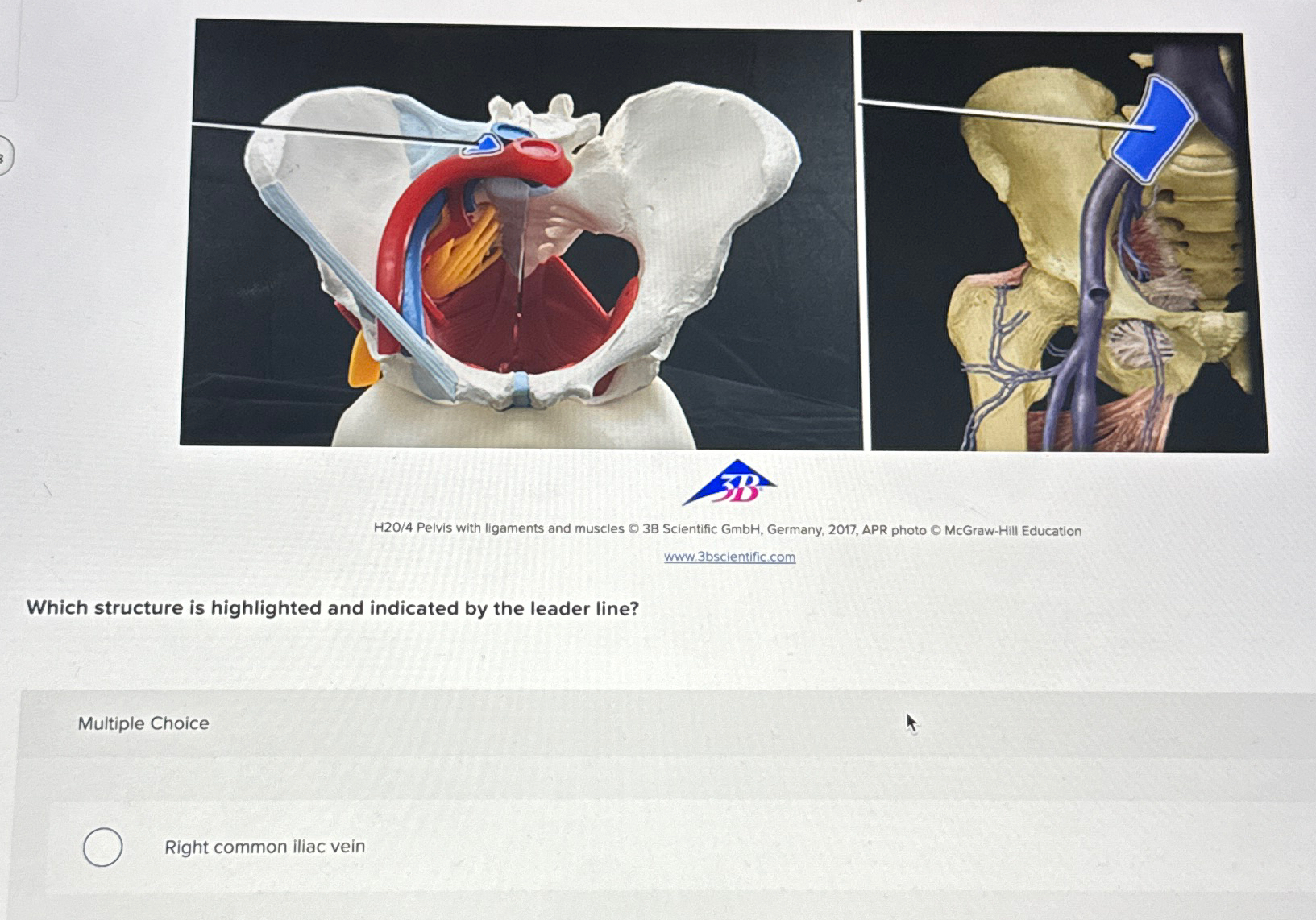 Solved H20/4 ﻿Pelvis with ligaments and muscles 38 | Chegg.com