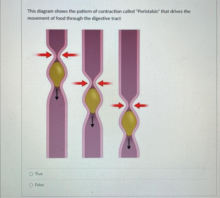 Solved This diagram shows the pattern of contraction called | Chegg.com