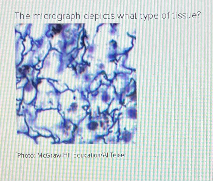 [Solved]: The micrograph depicts what type of tissue? Photo: