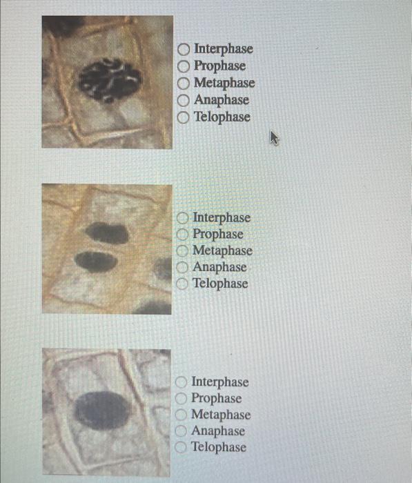 Solved Telophase Interphase Prophase Metaphase Anaphase | Chegg.com