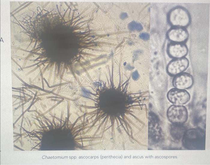 Solved 1. Which structures in the Aphanoascus | Chegg.com