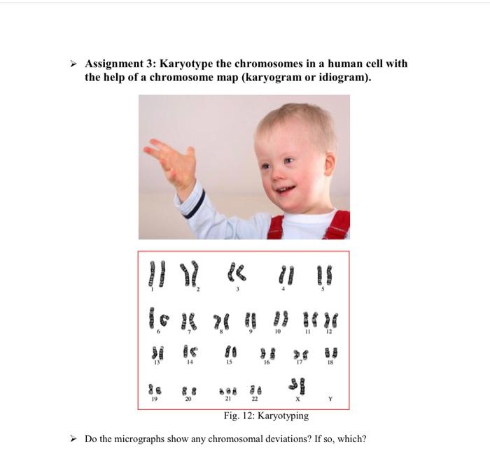 Solved Assignment 3: Karyotype the chromosomes in a human | Chegg.com