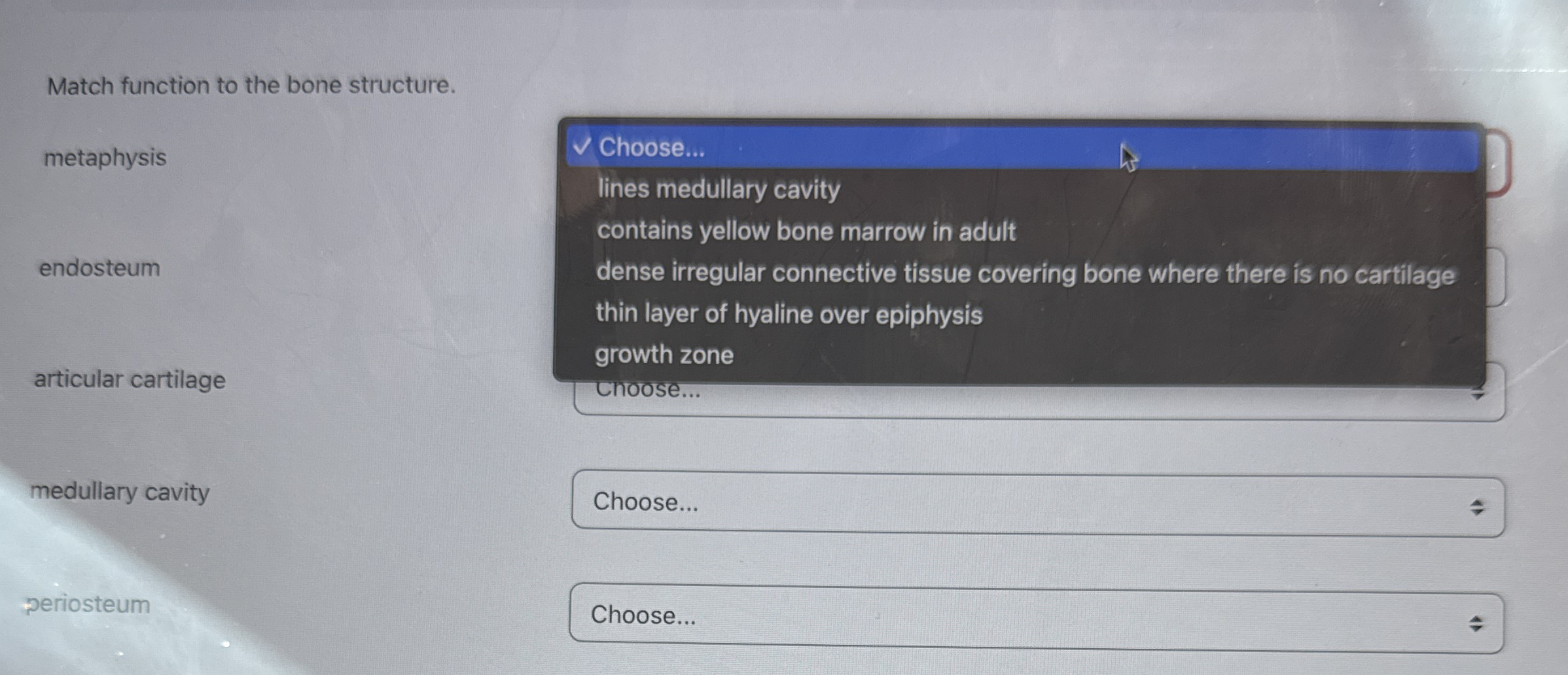 Solved Match function to the bone | Chegg.com