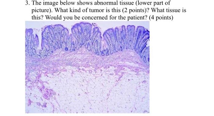Solved 3. The image below shows abnormal tissue (lower part | Chegg.com