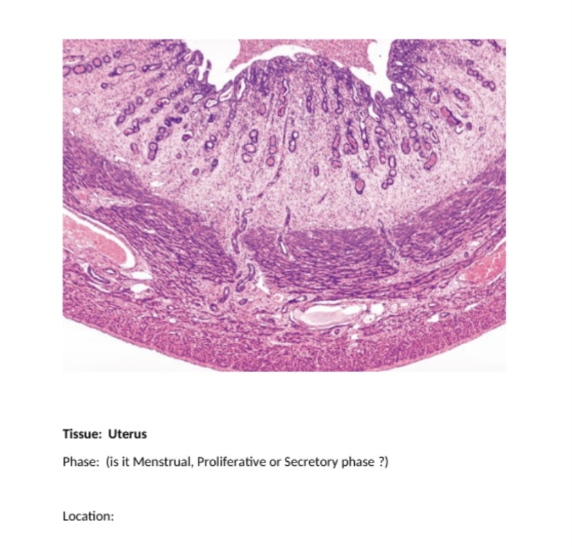 Solved Tissue: UterusPhase: (is it Menstrual, Proliferative | Chegg.com