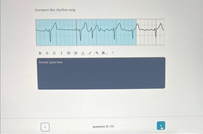 Solved Interpret this rhythm strip Interpret this rhythm | Chegg.com