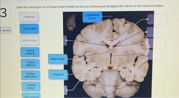 Solved Label the structures of a human brain frontal section | Chegg.com
