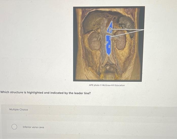 Solved APk photo O McGraw.Hill Education Which structure is | Chegg.com
