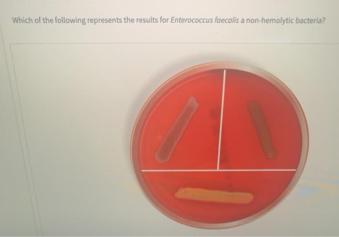 Solved Which of the following represents the results for | Chegg.com