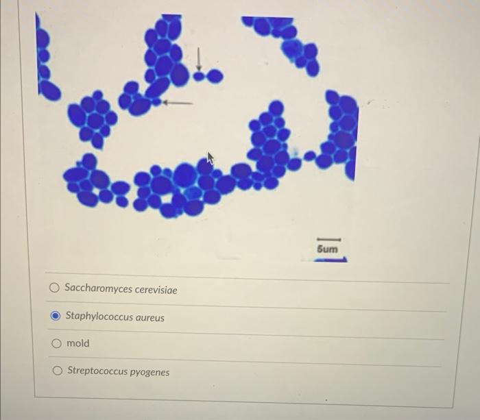 Solved Saccharomyces cerevisiae Staphylococcus aureus mold | Chegg.com