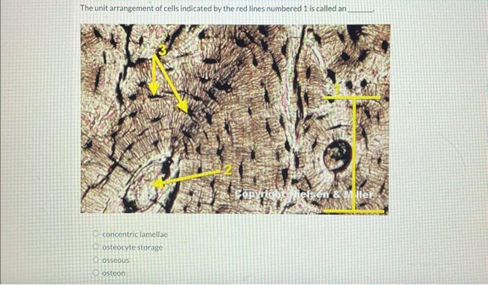 Solved The unit arrangement of cells indicated by the red | Chegg.com