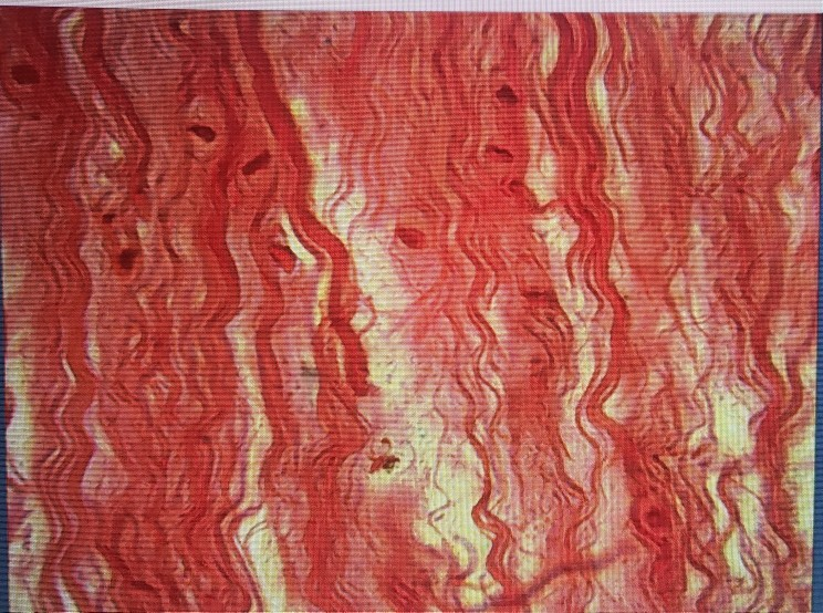 Solved LABEL a CHONDROCYTE, COLLAGEN FIBER, and LACUNA. | Chegg.com