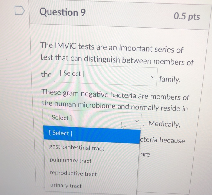 Solved Question 9 0.5 pts The IMVIC tests are an important | Chegg.com