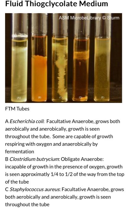 EXERCISE 14: BLOOD AGAR PLATE(BAP) Complete the table | Chegg.com
