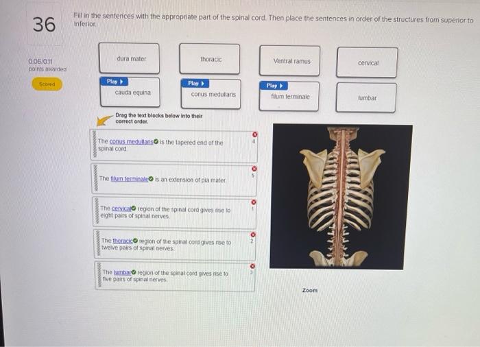 Solved Multigle Choice socral recion conus medullaris | Chegg.com
