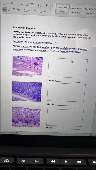 Lab Activity Chapter 4 Identify the tissues in the | Chegg.com