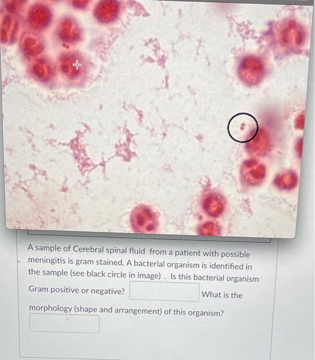 Solved + + A sample of Cerebral spinal fluid from a patient | Chegg.com