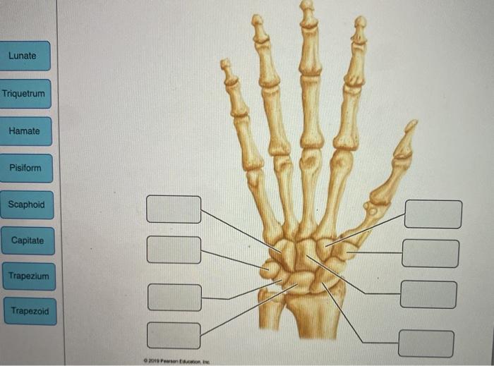 Solved Lunate Triquetrum Hamate Pisiform Scaphoid Capitate | Chegg.com