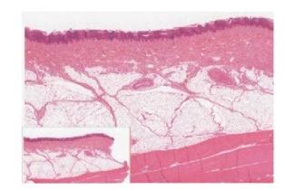 If you zoom on the cells at the outermost layer of | Chegg.com