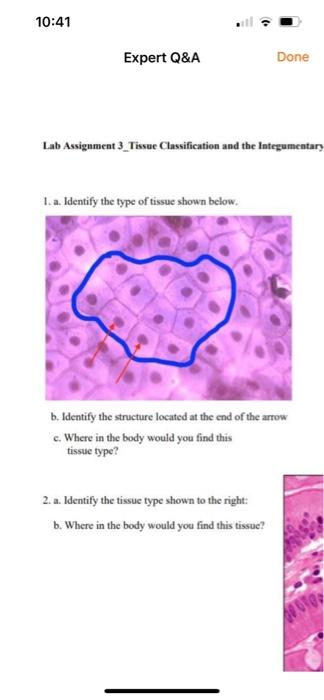 Solved Lab Assignment 3.Tissue Classification and the | Chegg.com
