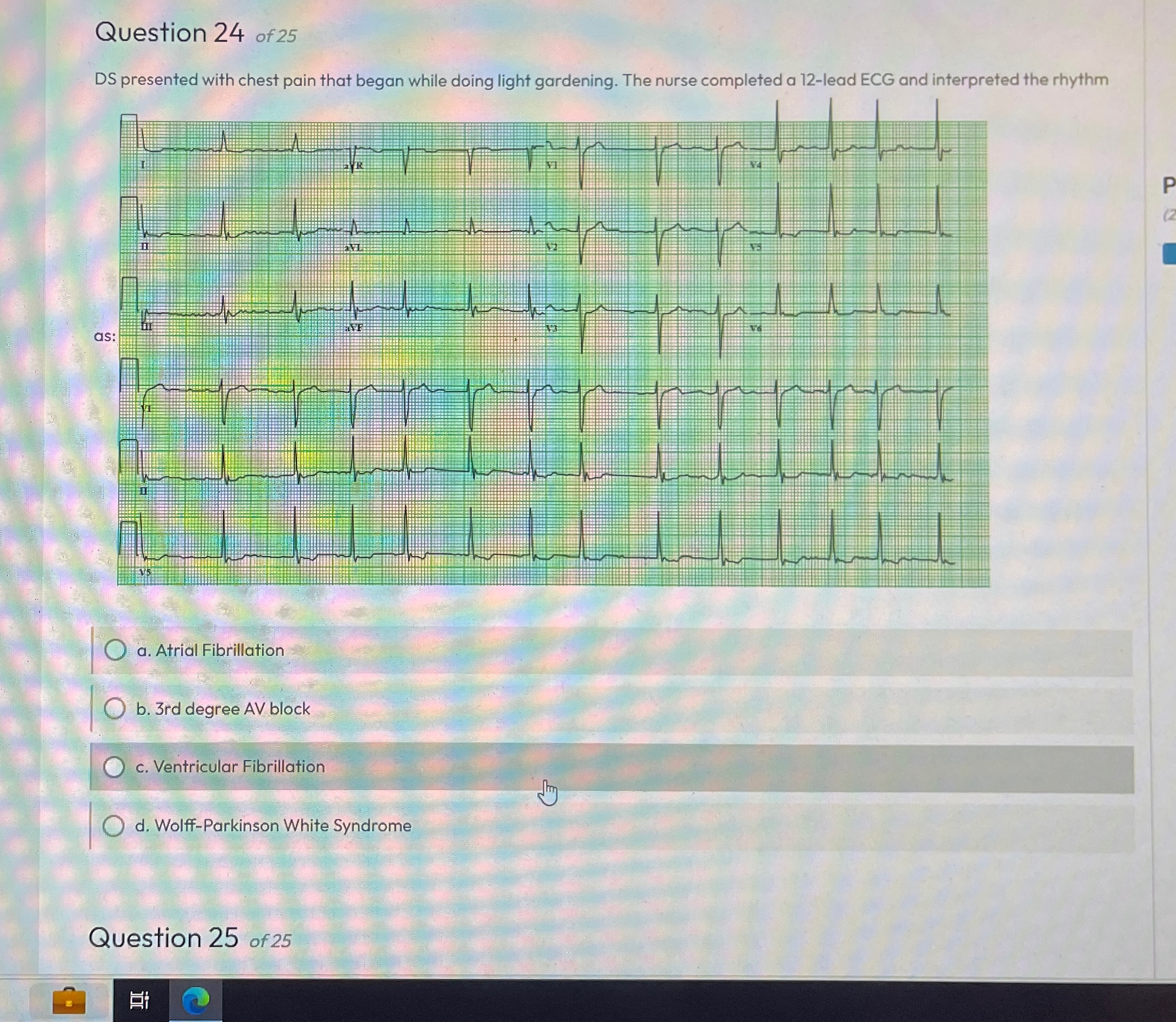 Solved Question 24 ﻿of 25DS presented with chest pain that | Chegg.com