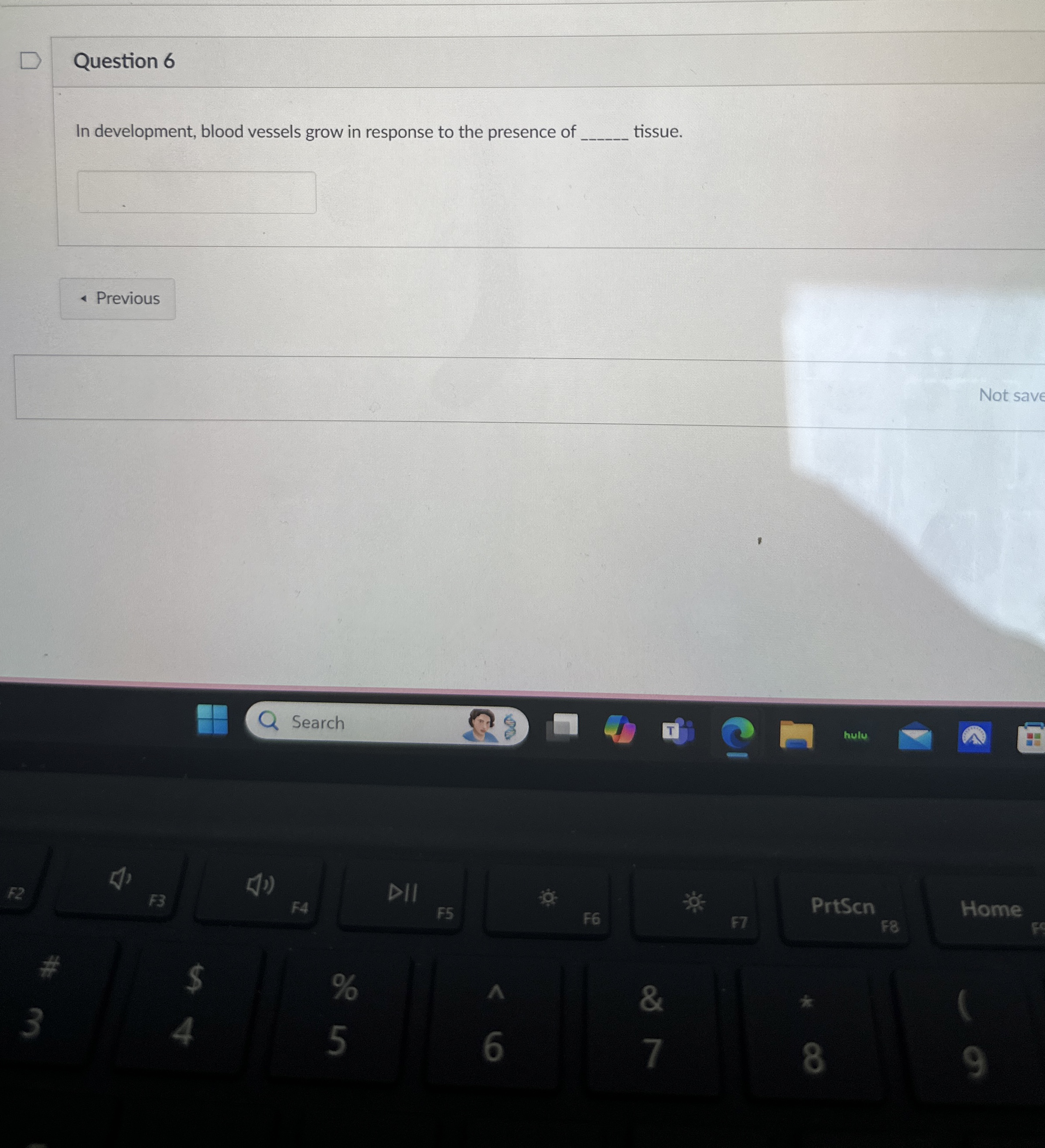 Solved Question 6In development, blood vessels grow in | Chegg.com
