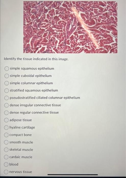 Solved Identify the tissue indicated in this image. simple | Chegg.com