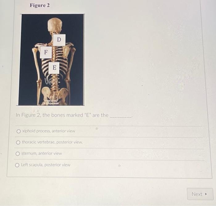 Figure 2 In Figure 2, the bones marked "E" are the | Chegg.com
