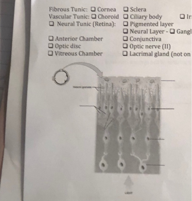 Solved Ir Fibrous Tunic: Cornea Sclera Vascular Tunic: O | Chegg.com