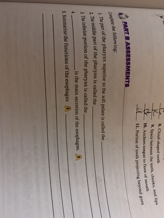 Solved 8. Chisel-shaped tooth d u 11. Portion of tooth | Chegg.com