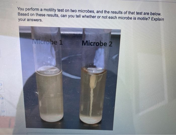 Solved You perform a motility test on two microbes, and the | Chegg.com