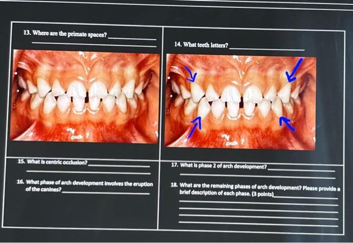 Solved Primary Dentition and Occlusion Review (Assignment | Chegg.com