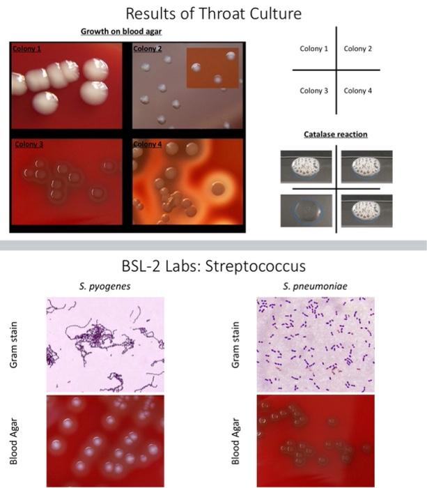 Solved Results of Throat Culture Growth on blood agar Colony | Chegg.com