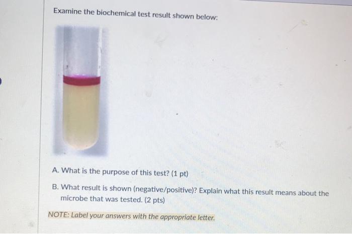 Solved Examine the biochemical test result shown below: A. | Chegg.com