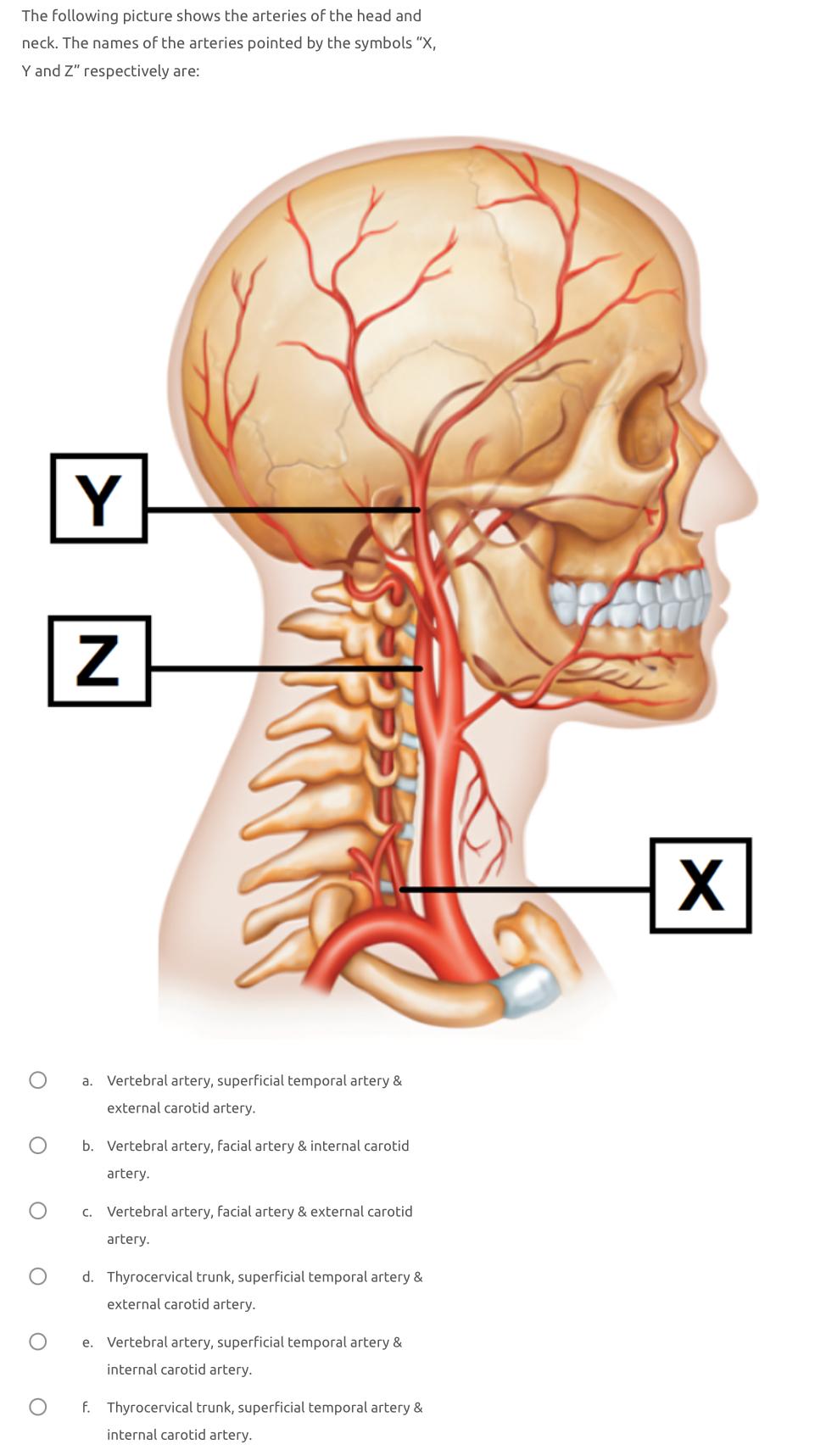 Solved The following picture shows the arteries of the head | Chegg.com