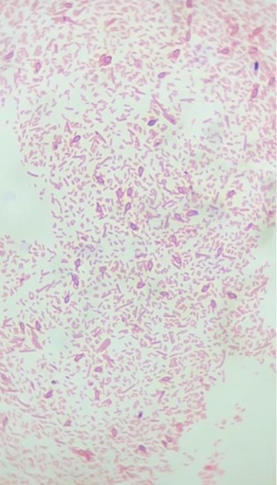 Solved list the possible microorganisms on the gram stain | Chegg.com