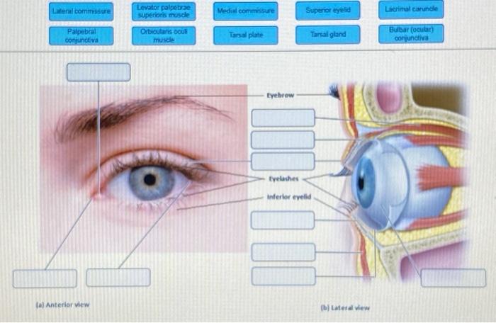 Solved Lateral commissure Palpebral conjunctiva (a) Anterior | Chegg.com