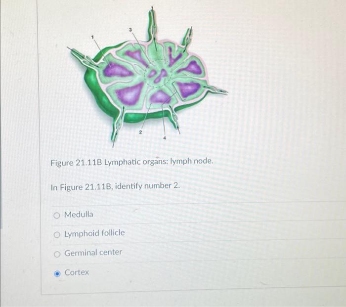 Solved Figure 21.11B Lymphatic organs: lymph node. O Medulla | Chegg.com