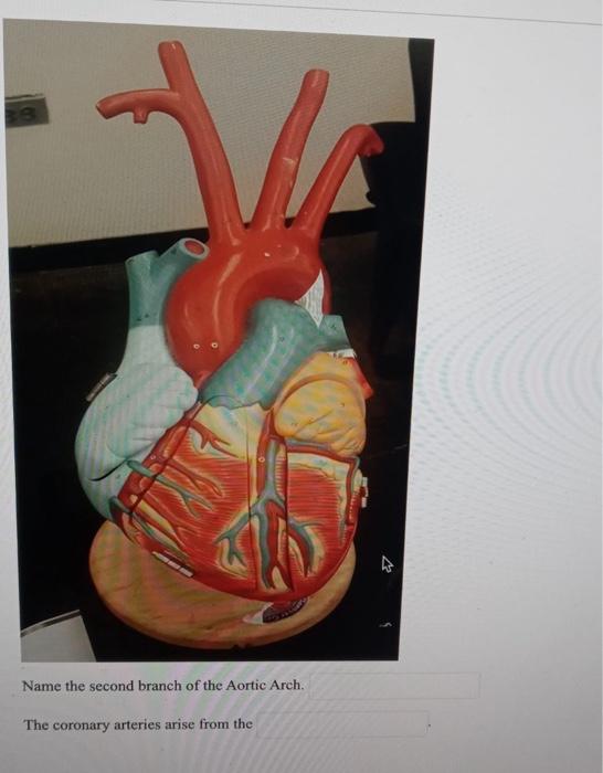 Solved Name the second branch of the Aortic Arch. The | Chegg.com