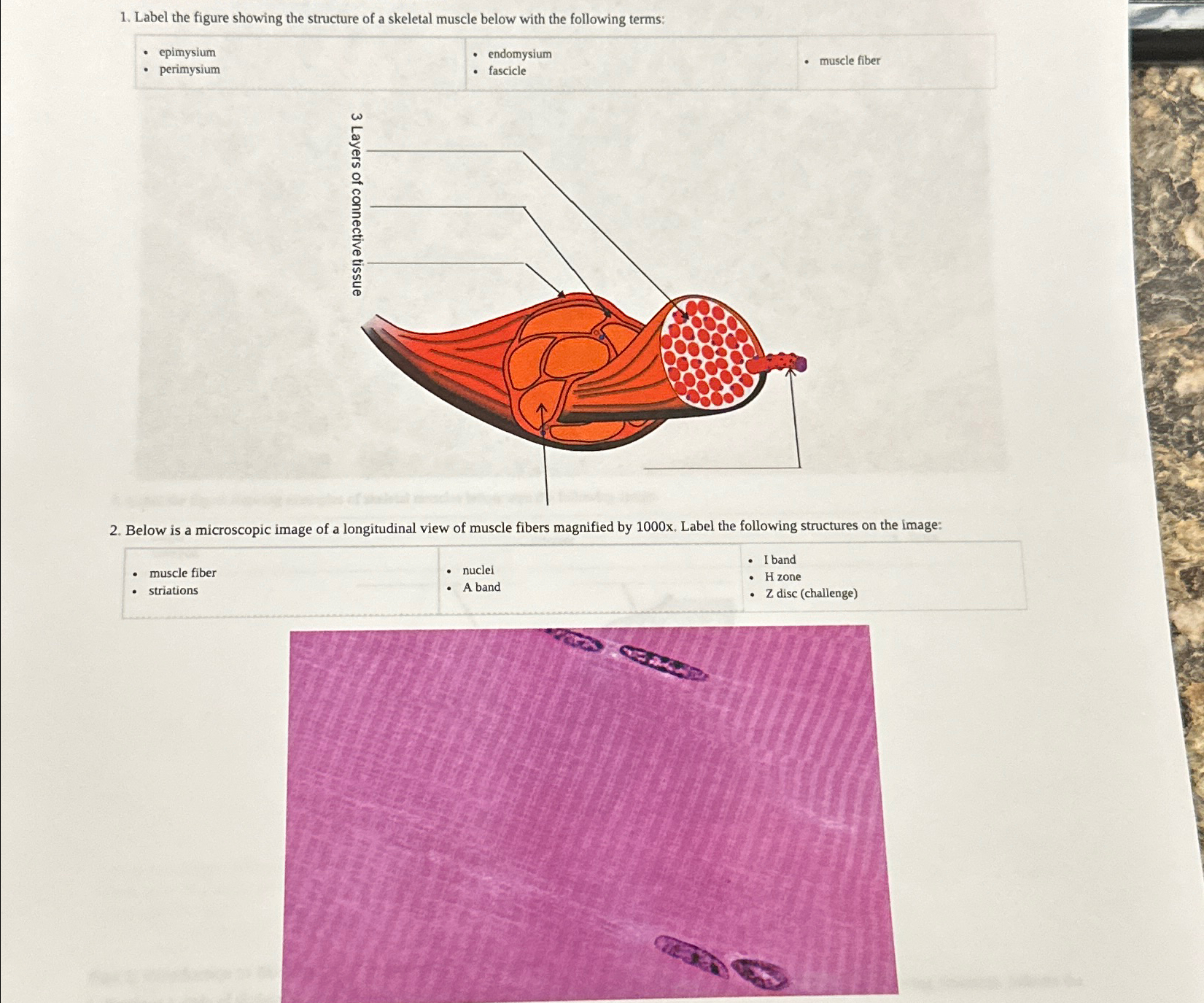 Label the figure showing the structure of a skeletal | Chegg.com